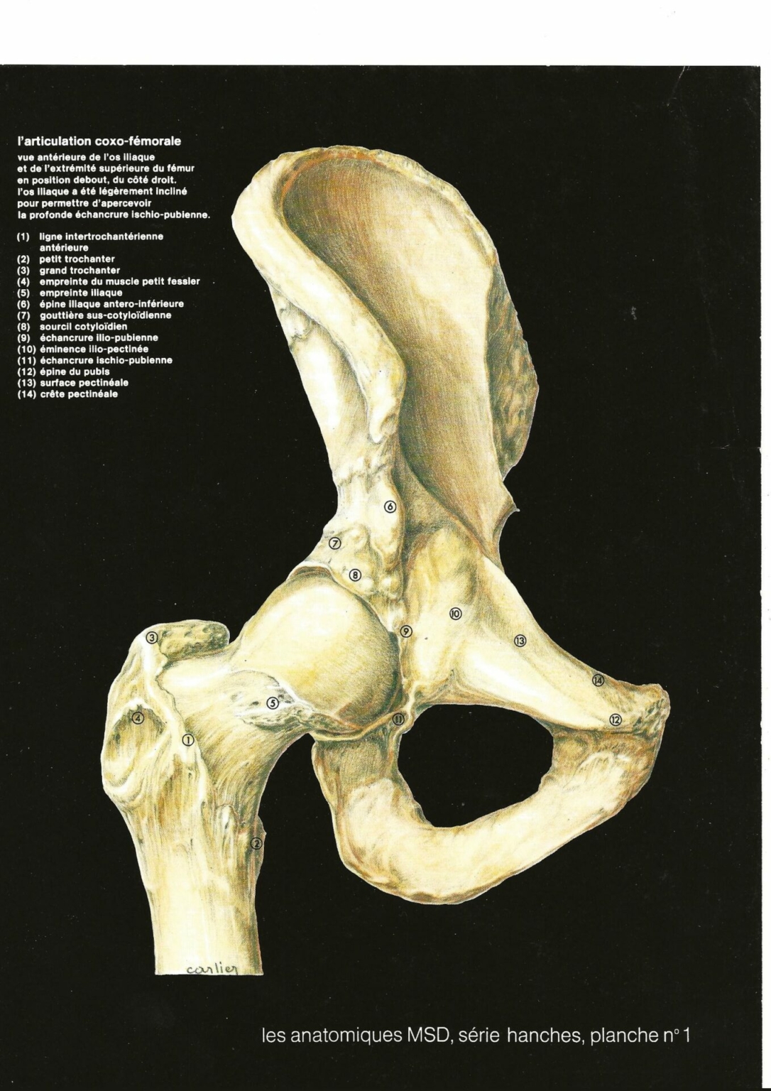 Coxarthrose : l'arthrose débutante de la hanche - Running Attitude